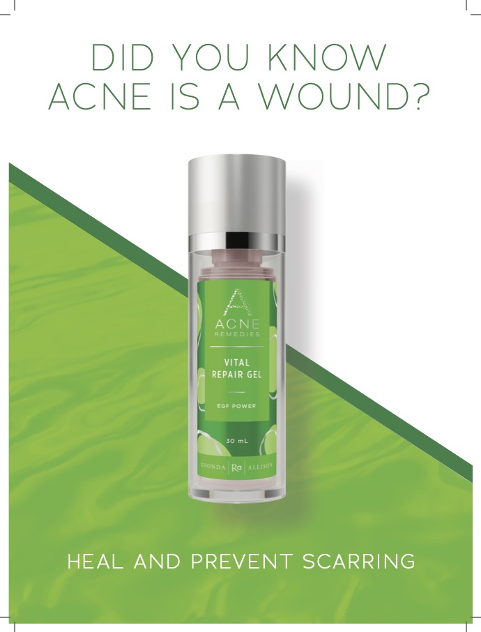 Acne Remedies Counter Card - Vital Repair – RA Skin Care